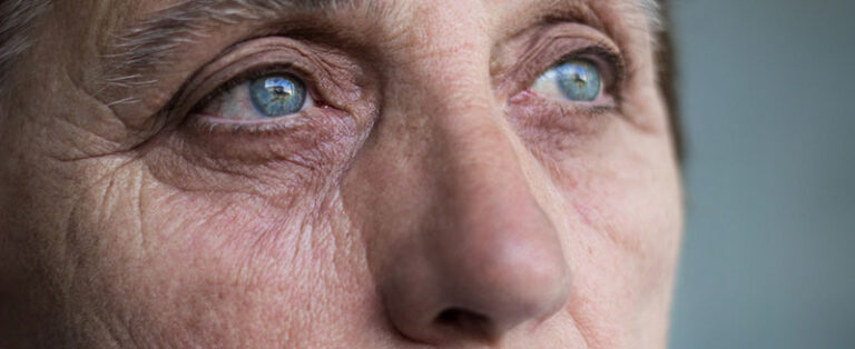Understanding How Dementia May Create Vision Problems